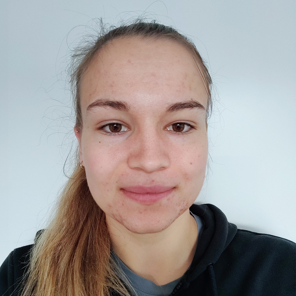 Mixed Skin | Filabé of Switzerland