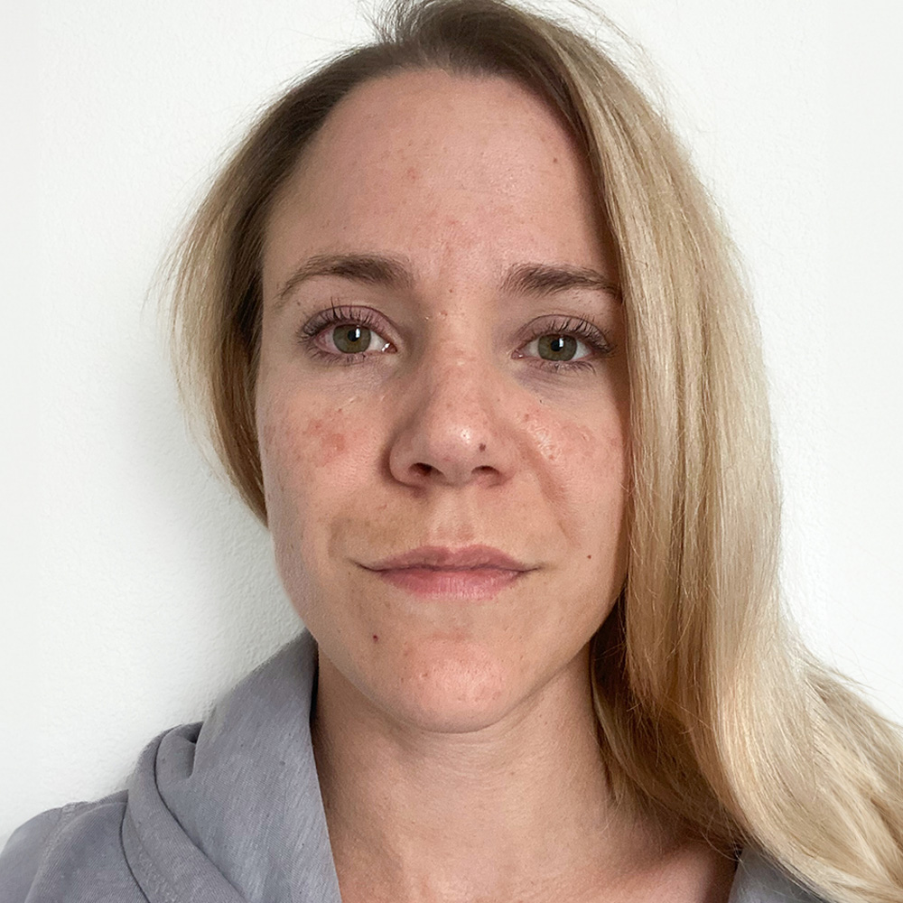 Mixed Skin | Filabé of Switzerland